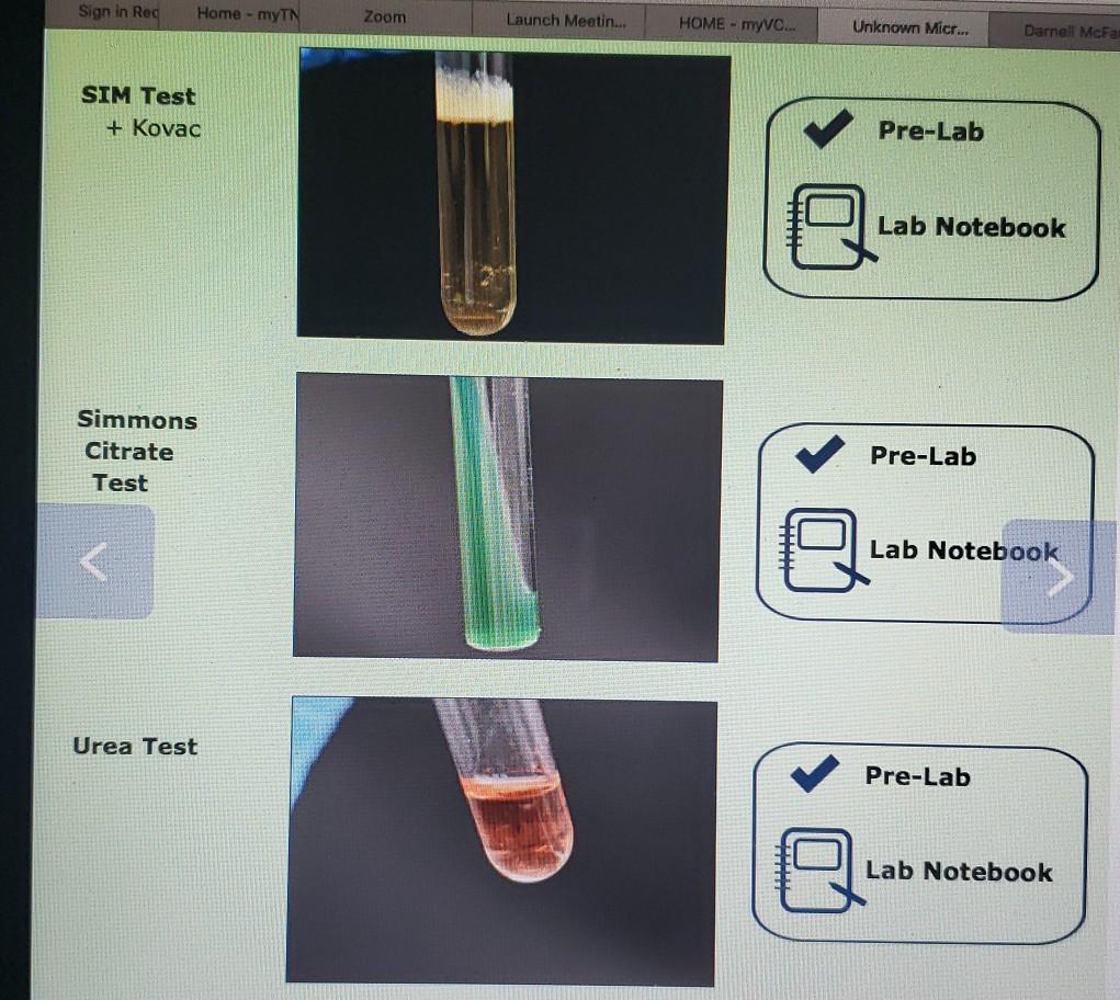 Solved 13. Describe your observations of the SIM test: B TVE | Chegg.com