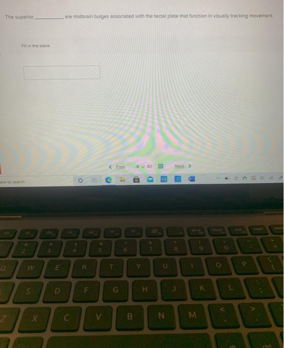 Solved The superior are midbrain bulges associated with the | Chegg.com