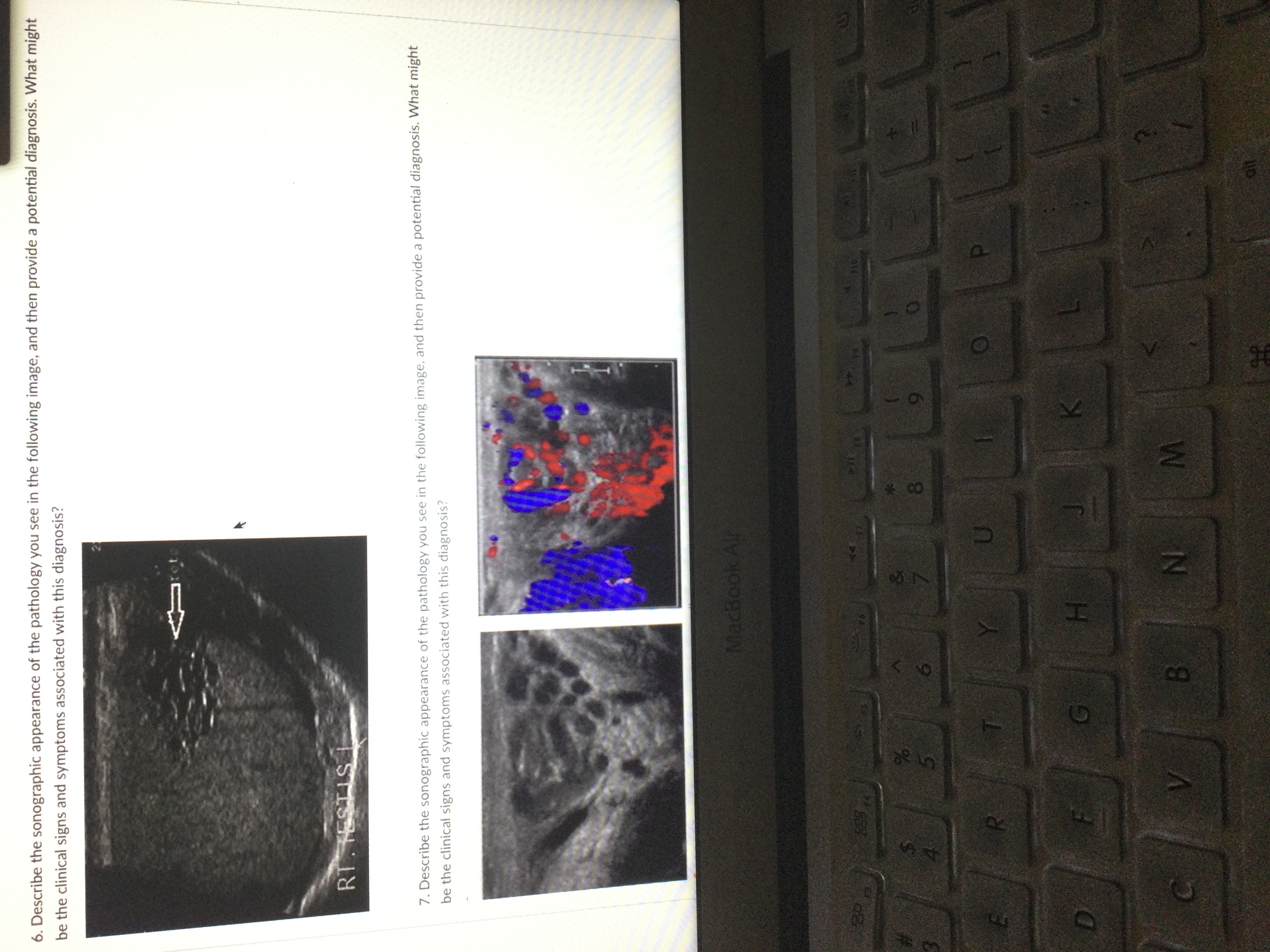 Solved 1. ﻿What are the indications for scrotal ultrasound? | Chegg.com