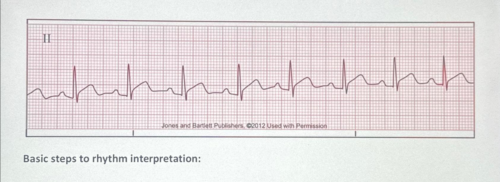 Solved Basic steps to rhythm interpretation: | Chegg.com