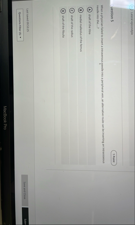 Solved (D) ﻿Lateral epicondyleuestion 5 When a physician | Chegg.com