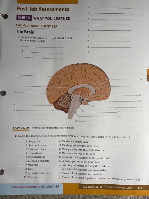 Post-lab Assessments 4. 5. CHECK WHAT YOU LEARNED 6. | Chegg.com