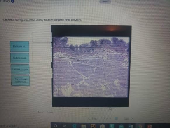 Solved label the micrograph of the urinary bladder using the | Chegg.com
