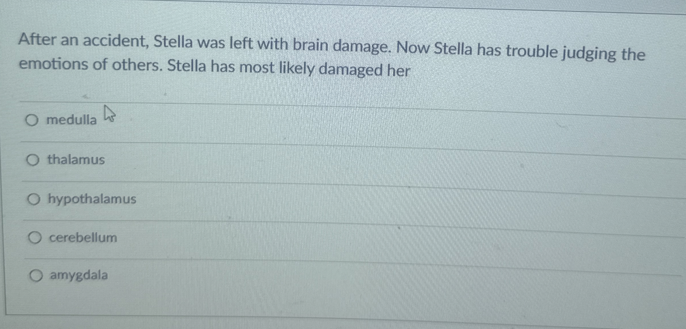 Solved After an accident, Stella was left with brain damage. | Chegg.com