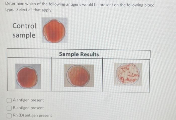 Determine which of the following antigens would be | Chegg.com