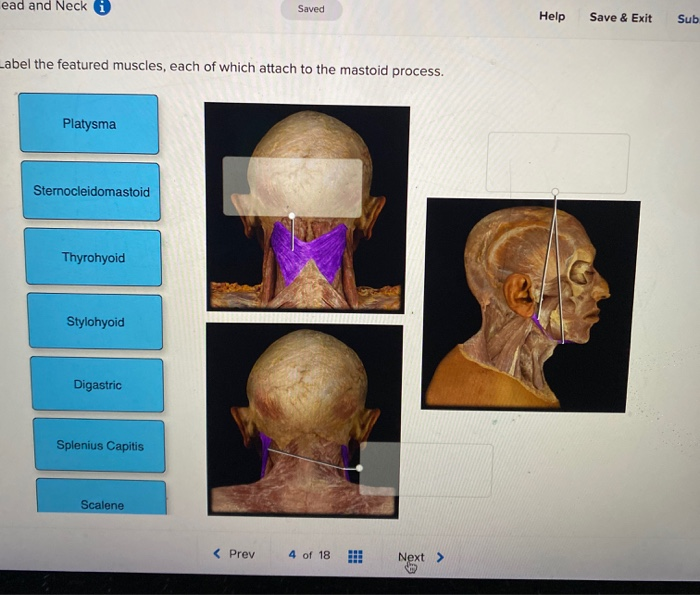 Solved ead and Neck Saved Help Save & Exit Sub Label the | Chegg.com