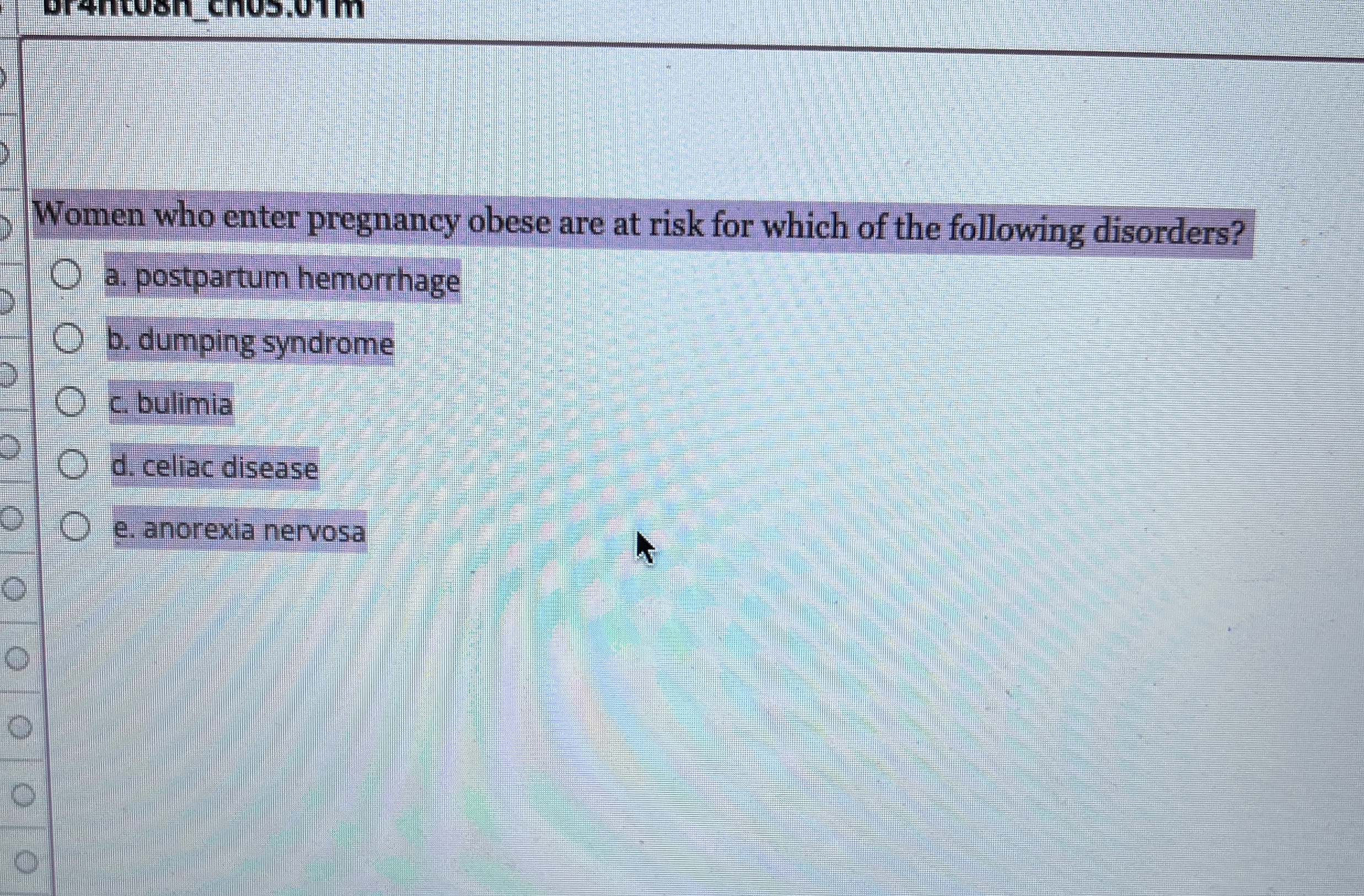 Solved Women who enter pregnancy obese are at risk for which | Chegg.com