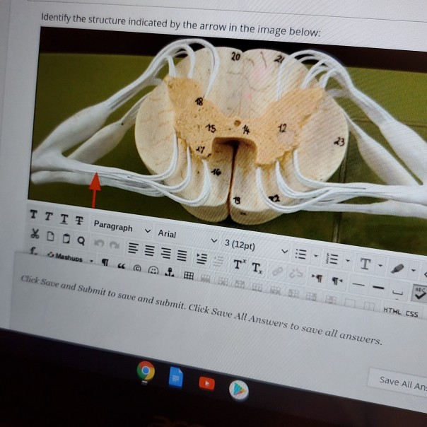 Solved Identify the structure indicated by the arrow in the | Chegg.com