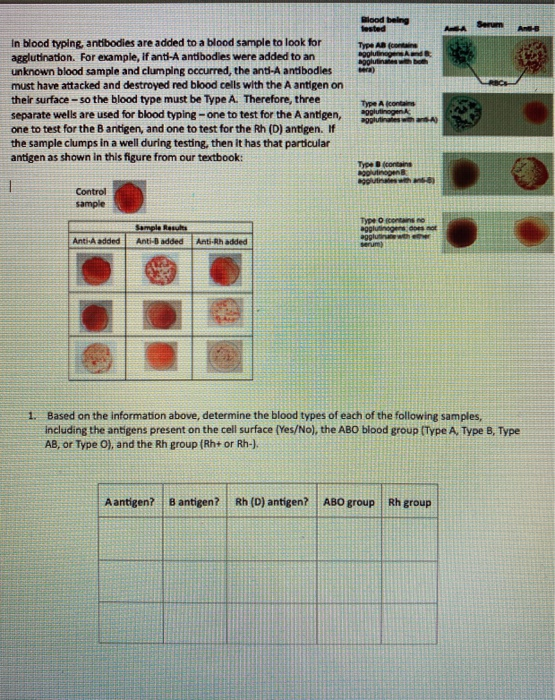 Solved Blood being AN Type AB aggluting and opline In blood | Chegg.com