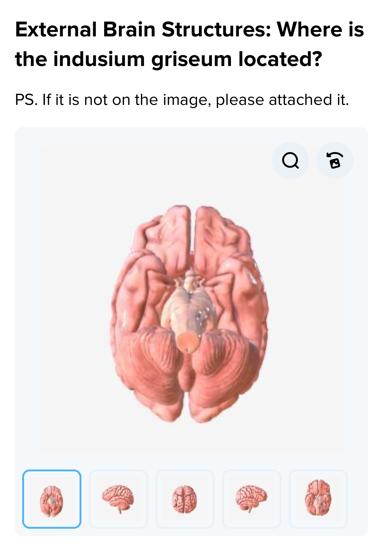 Solved External Brain Structures: Where is the indusium | Chegg.com