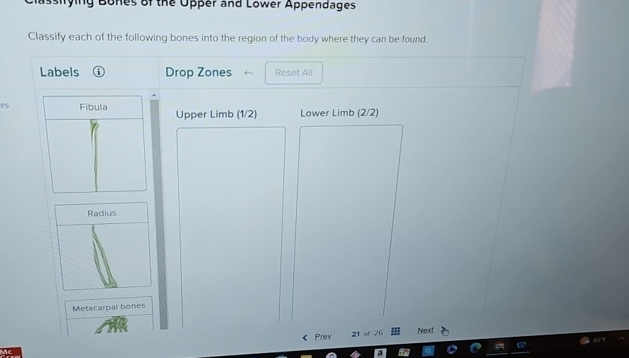 Solved Classify each of the following bones into the region | Chegg.com