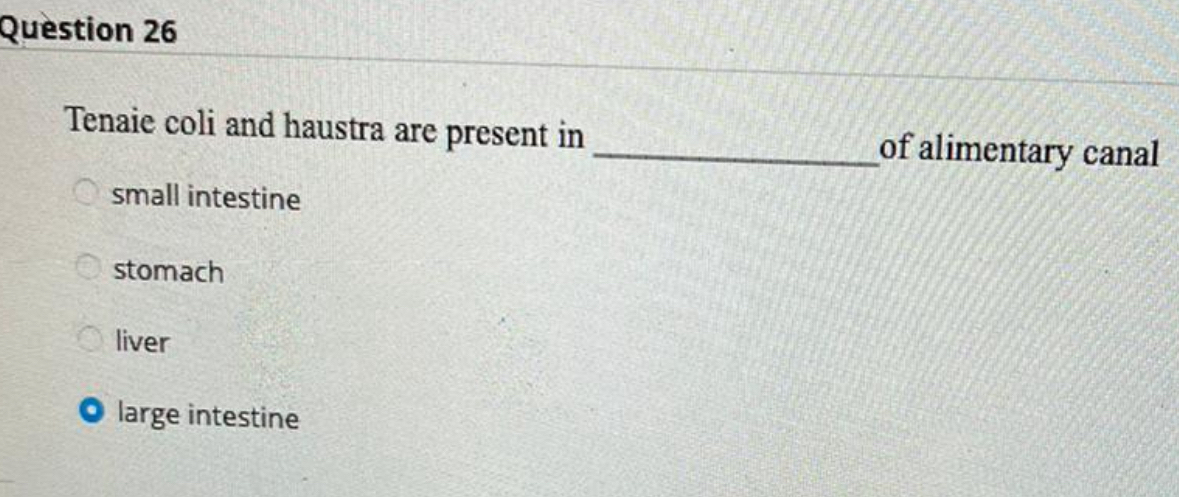 Solved Question 26Tenaie coli and haustra are present | Chegg.com