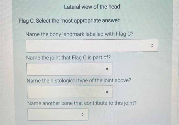 Solved Flag C: Select the most appropriate answer:Lateral | Chegg.com