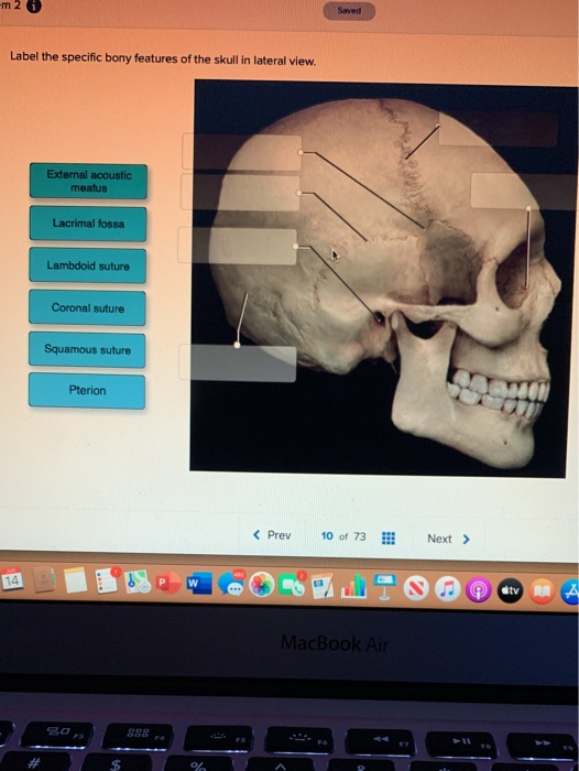 Solved m 2 Served Label the specific bony features of the | Chegg.com