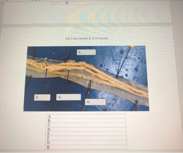 Solved Paragraph Activity 2. Ascaris lumbricoides (human | Chegg.com