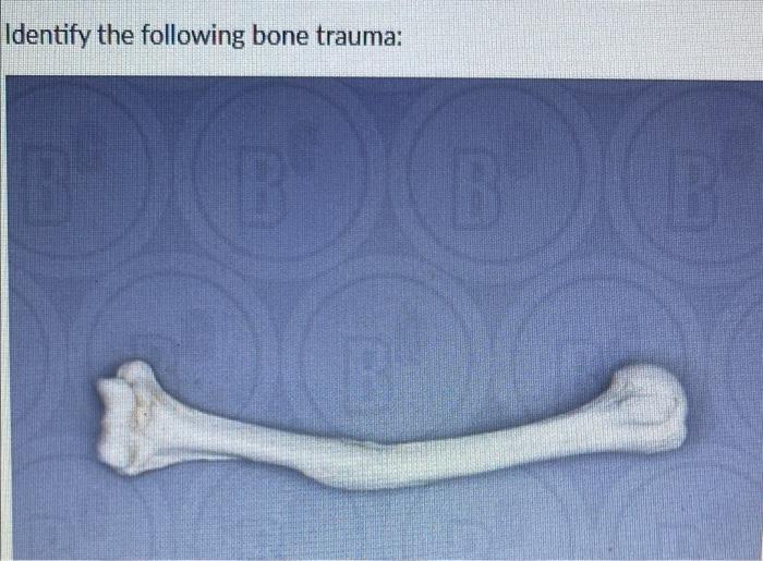 Solved Identify the following bone trauma: 18 B (0) B B | Chegg.com
