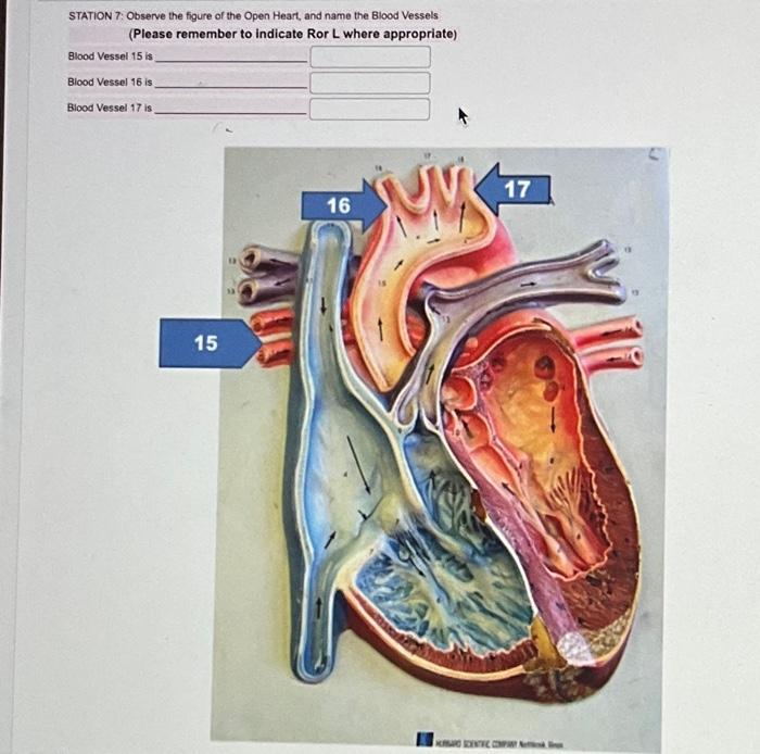 Solved STATION 7: Observe the figure of the Open Heart, and | Chegg.com