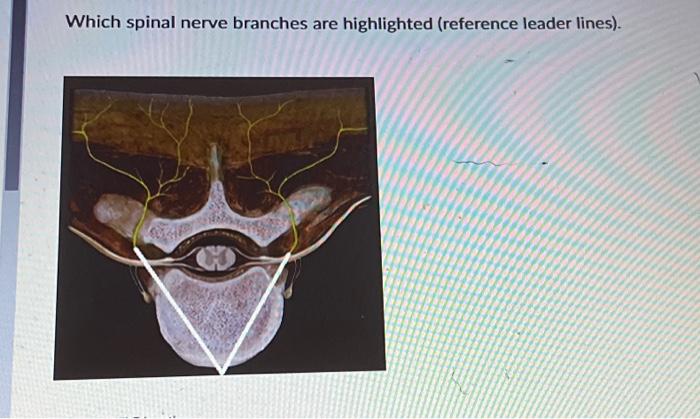 Solved Name the embryonic brain vesicle labeled 5 in this | Chegg.com