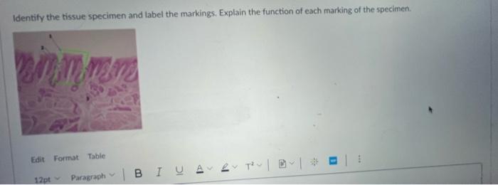 Solved Identify the tissue specimen and label the markings. | Chegg.com