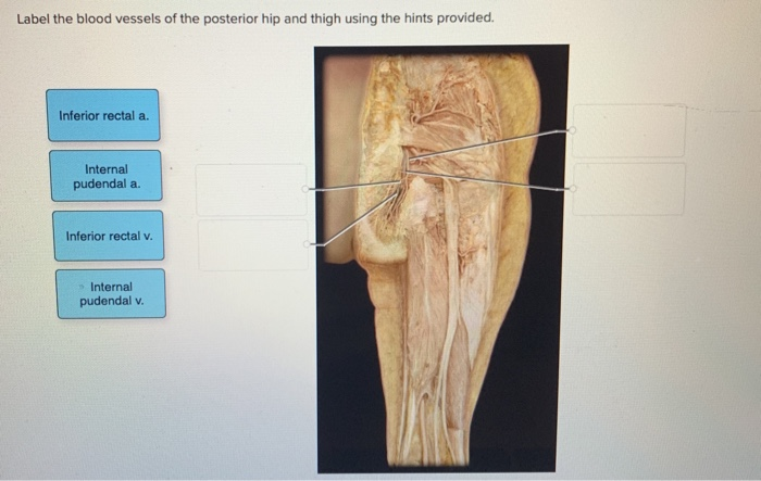 Solved Label the blood vessels of the posterior hip and | Chegg.com