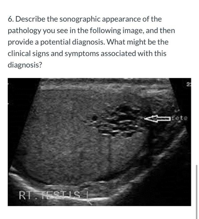 Solved 6. Describe the sonographic appearance of the | Chegg.com