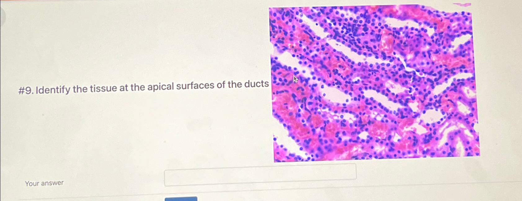 Solved #9. ﻿Identify the tissue at the apical surfaces of | Chegg.com