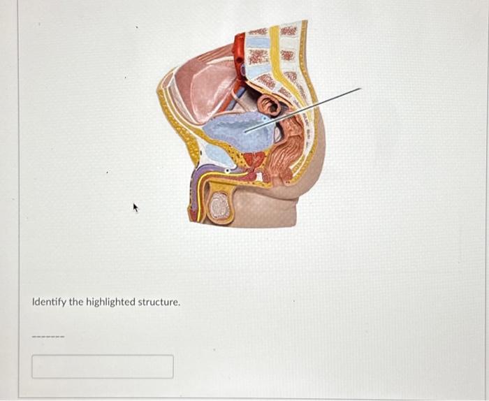 Solved Identify the highlighted structure. | Chegg.com