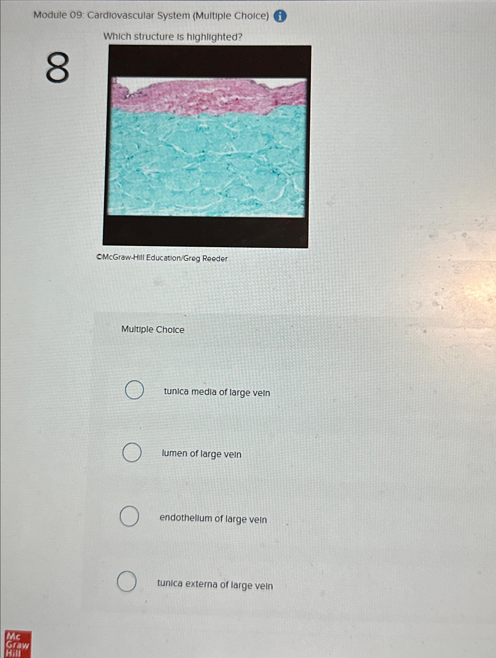Solved Module 09: Cardiovascular System (Multiple Choice) | Chegg.com