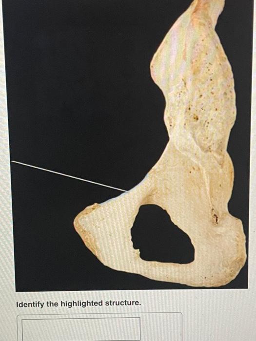 Solved Part A Identify the highlighted structures. | Chegg.com