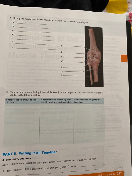 Solved 2. Identify the structures of the knee (posterior | Chegg.com