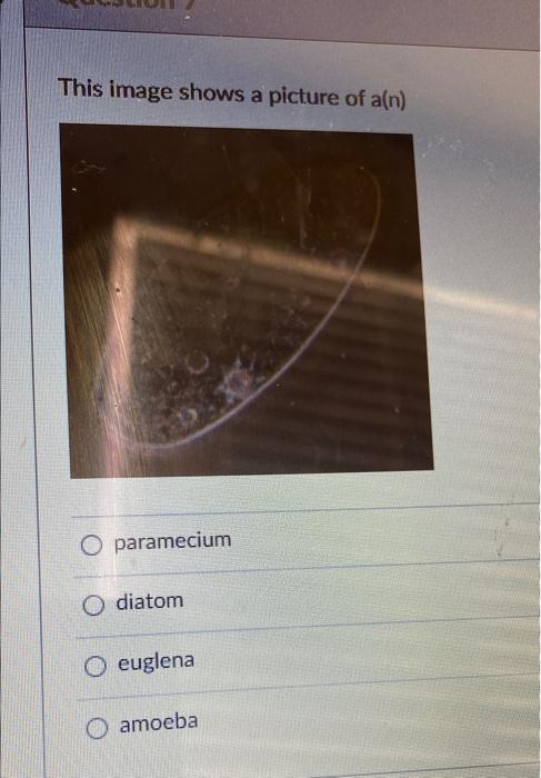 Solved This is an EMB plate. Which color streak is from E. | Chegg.com