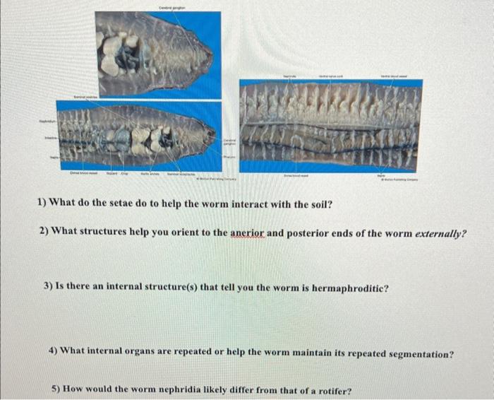 Solved 1) What do the setae do to help the worm interact | Chegg.com