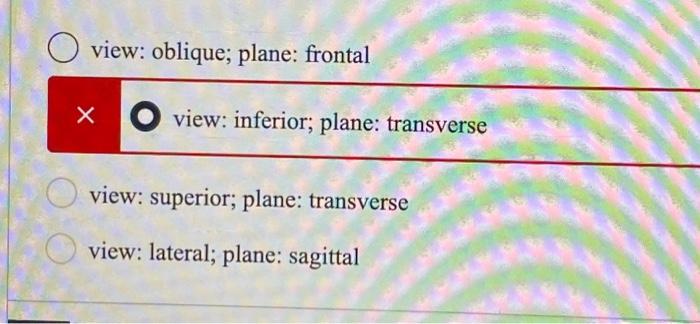 Solved What is the view orientation and what sectional plane | Chegg.com