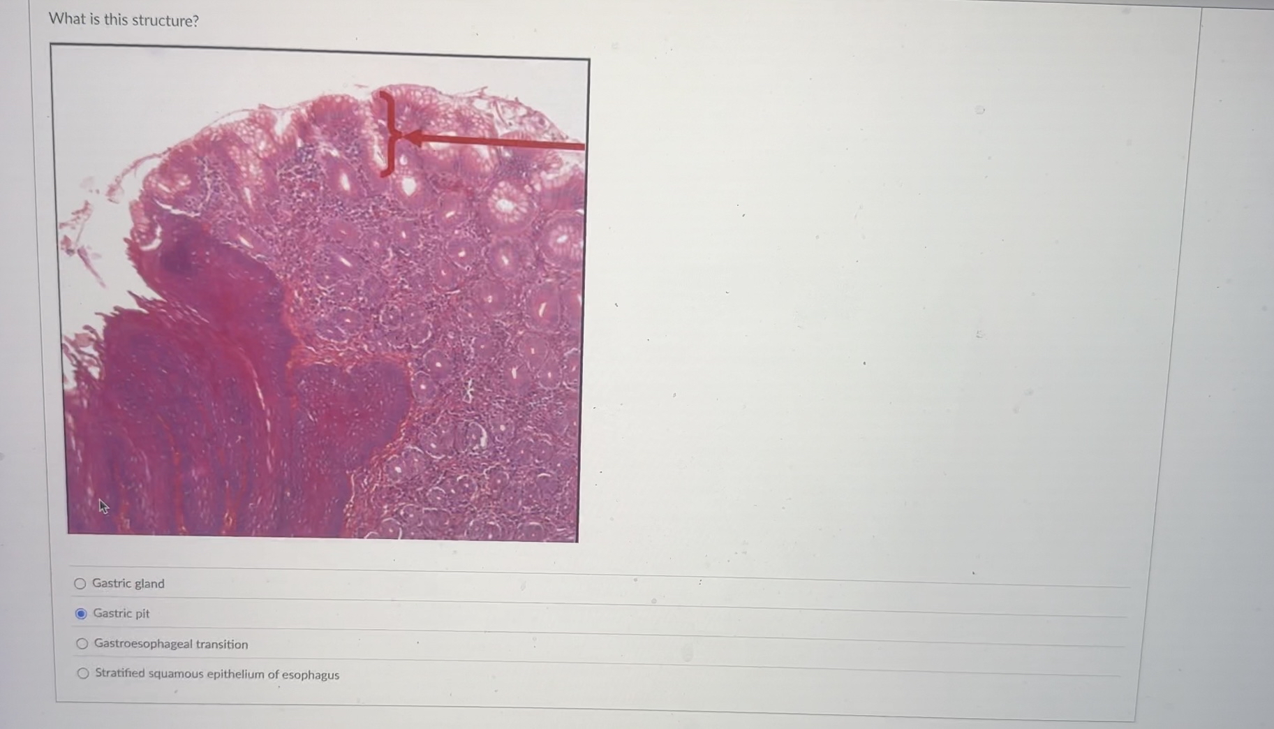 Solved What is this structure?Gastric glandGastric | Chegg.com