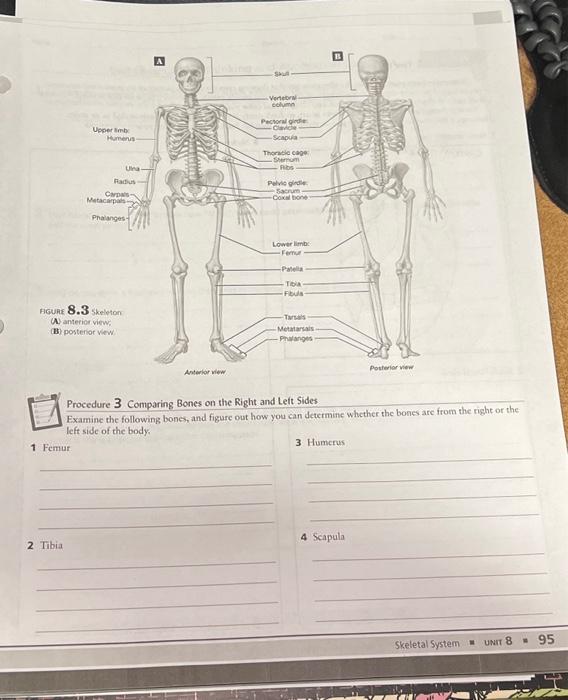 Solved Procedure 3 Comparing Bones on the Right and Left | Chegg.com
