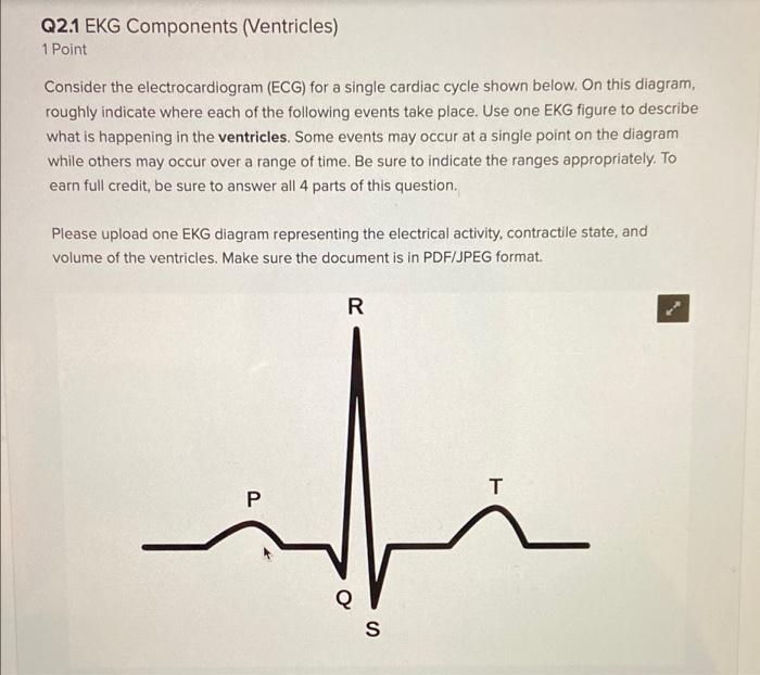 Solved Q2.1 EKG Components (Ventricles) 1 Point Consider the | Chegg.com