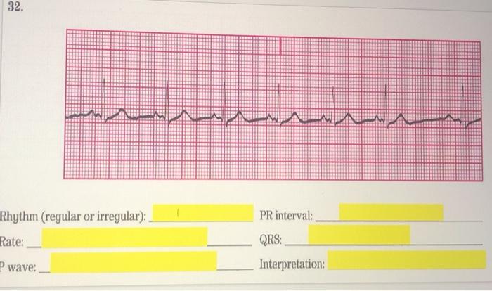 Solved 30. Rhythm (regular or irregular): PR interval: QRS: | Chegg.com