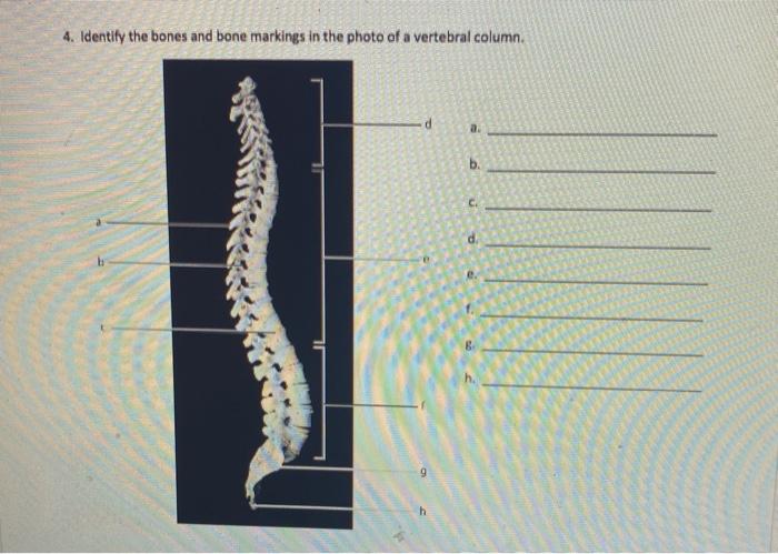 Solved 4. Identify the bones and bone markings in the photo | Chegg.com