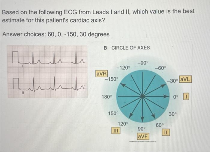 Solved Based on the following ECG from Leads I and II, which | Chegg.com