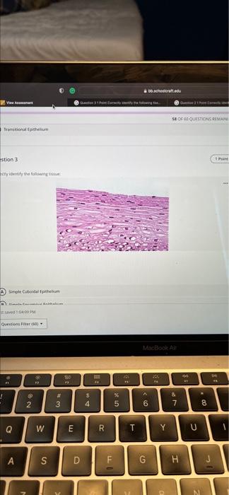 Solved View Assessment Transitional Epithelium estion 3 | Chegg.com
