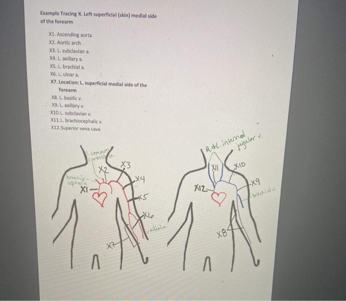 Blood Tracing and Map (50 pts): For the 4 locations | Chegg.com