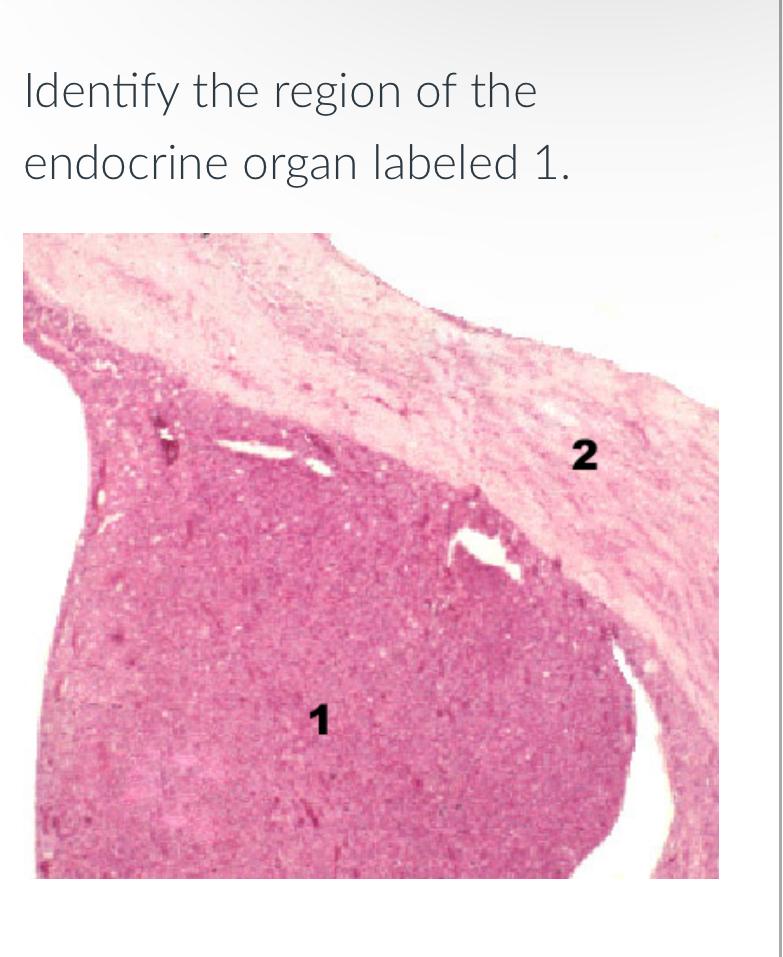 Solved Identify the region of the endocrine organ labeled 1. | Chegg.com