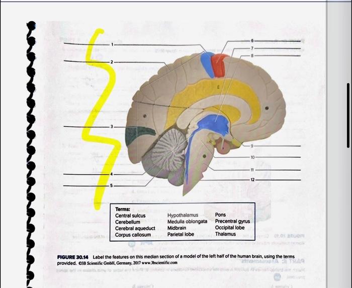 Solved FICURE 30.14 Label the features on this median | Chegg.com
