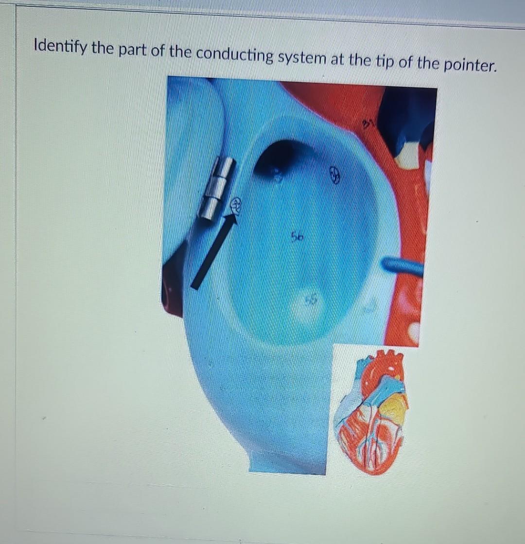 Solved Identify the part of the conducting system at the tip | Chegg.com
