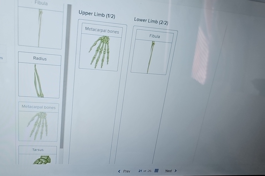 Solved Upper Limb (1/2)Lower Limb (2/2)Prov21 ﻿of 26Next | Chegg.com