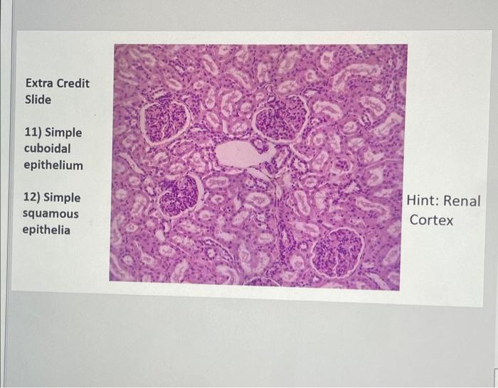 Solved Extra Credit Slide 11) Simple cuboidal epithelium 12) | Chegg.com