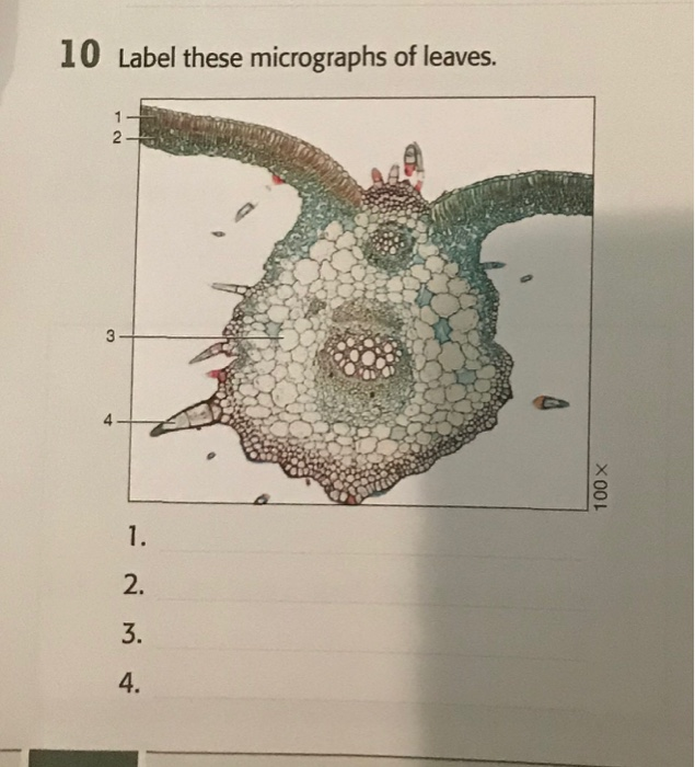 Solved 10 Label these micrographs of leaves. 1 2 3 100 x 1. | Chegg.com