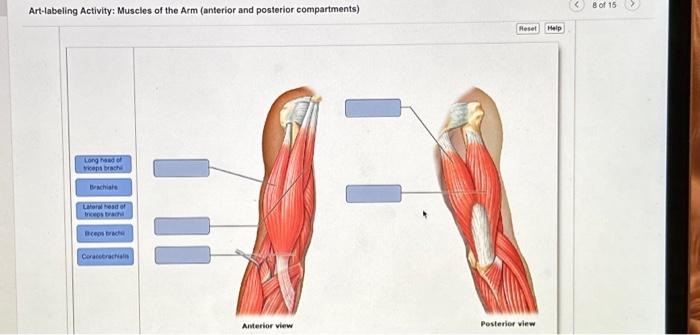 Solved Art-labeling Activity: Muscles of the Arm (anterior | Chegg.com