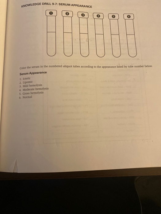 Solved OWLEDGE DRILL 9-7: SERUM APPEARANCE Color the serum | Chegg.com