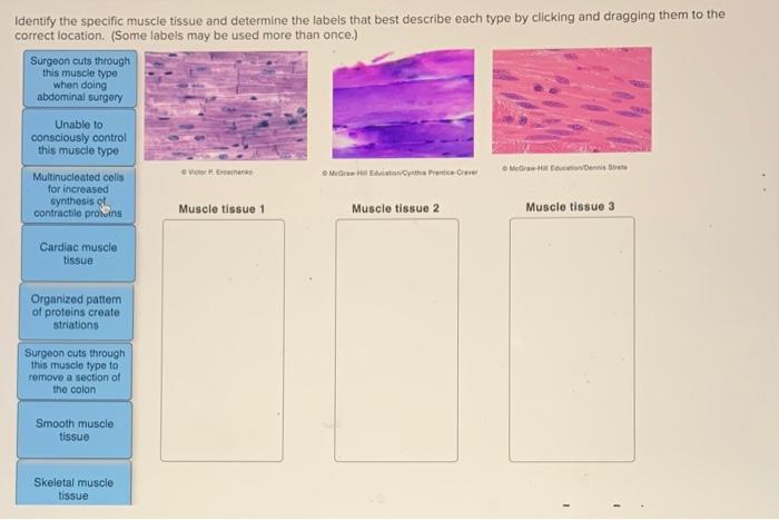 Solved Identify the specific muscle tissue and determine the | Chegg.com Solved Identify the specific muscle tissue and determine the | Chegg.com